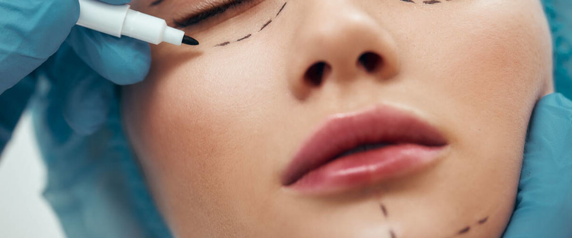 Everything You Need to Know About Injectable Treatments